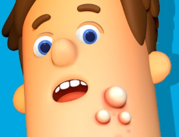 Doctor Pimple Game Play Online for Free